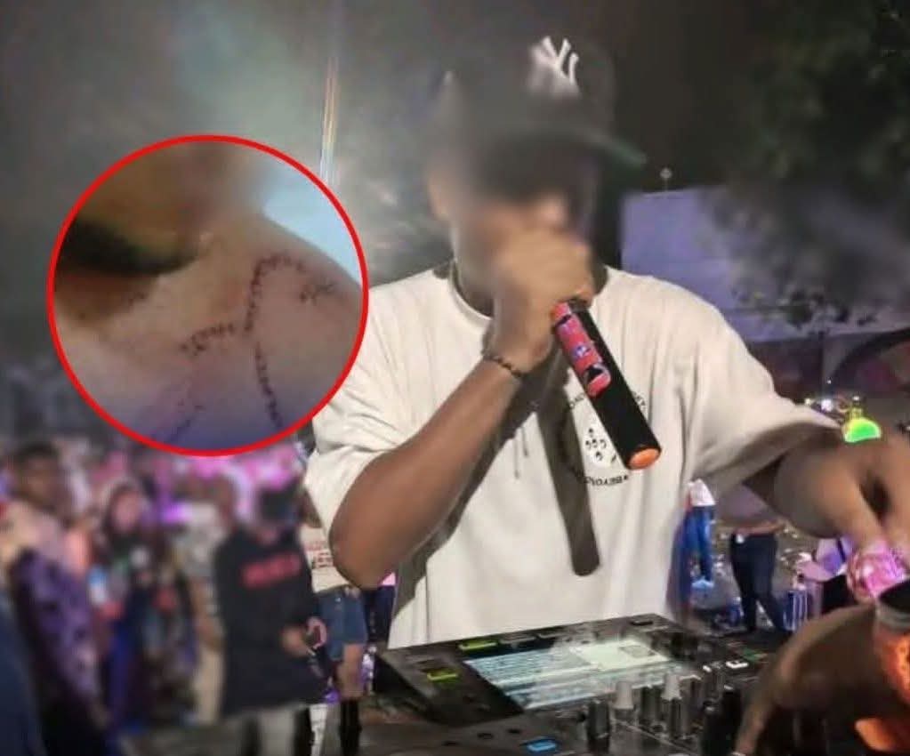 Con un pico de botella DJ fue apuñalado en Lorica por no colocar una ...